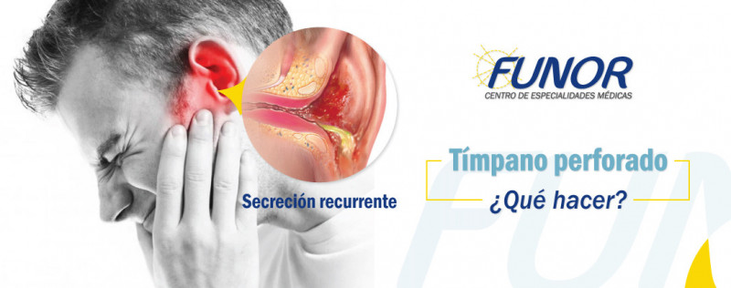 FUNOR | Síntomas de la ruptura de Tímpano